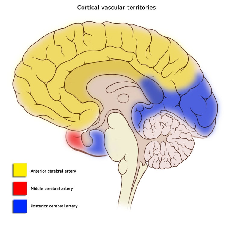 후대뇌동맥 경색(posterior cerebral artery territory infarction). 정상 기능, 증상, 예후 ...