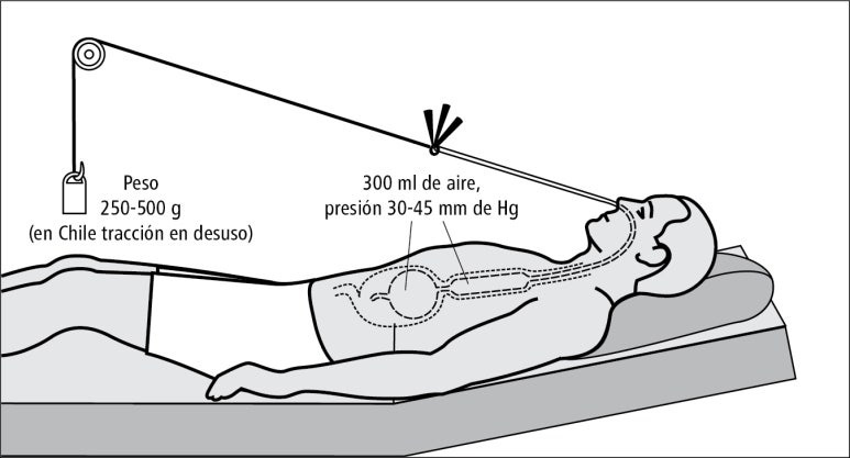 GI emergencies : 네이버 블로그