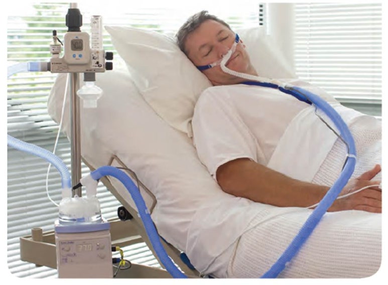 Optiflow : 네이버 블로그